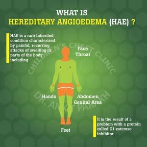 Hereditary Angioedema: Causes, Symptoms, and Treatment – Dr. Ankit ...