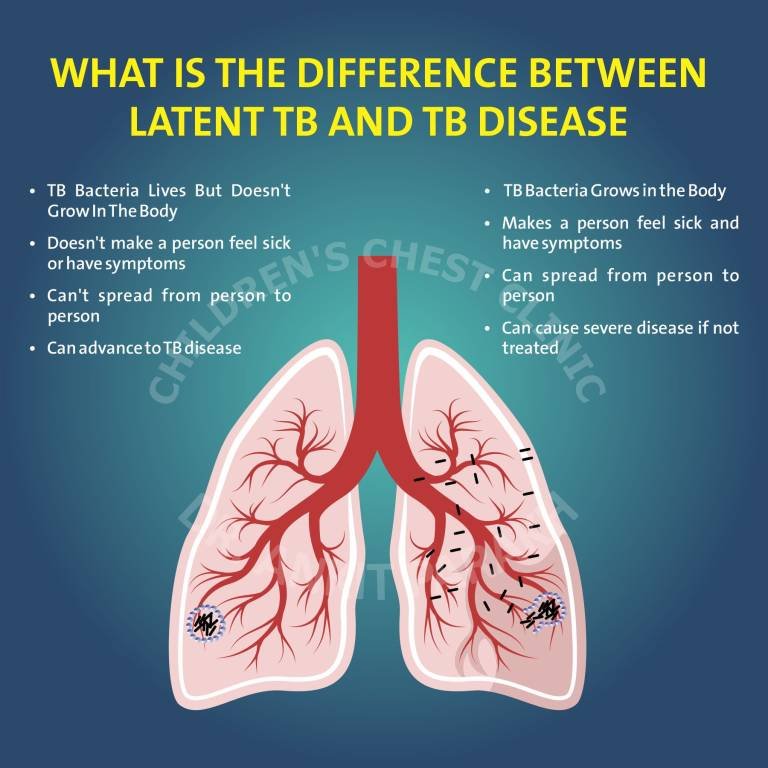 Latent Tuberculosis Or Tuberculosis Disease What Is The Difference 