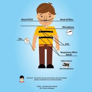 Cardiorespiratory Sleep Study for children – Dr. Ankit Parakh – India's ...