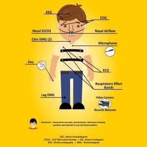 Polysomnography for children – Dr. Ankit Parakh – India's best ...