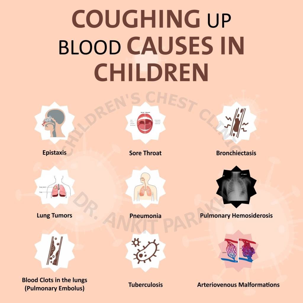Is your child having Hemoptysis or Coughing up blood!! - Dr. Ankit ...