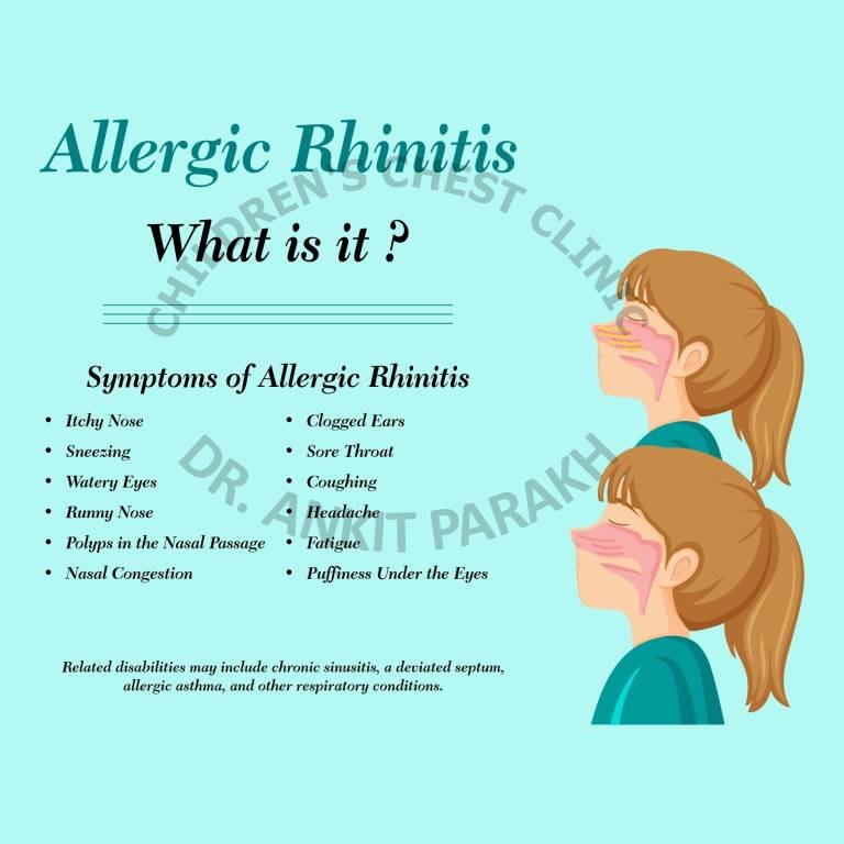 Allergic Rhinitis Or Nasal Allergy What Is It Dr Ankit Parakh Indias Best Pediatric