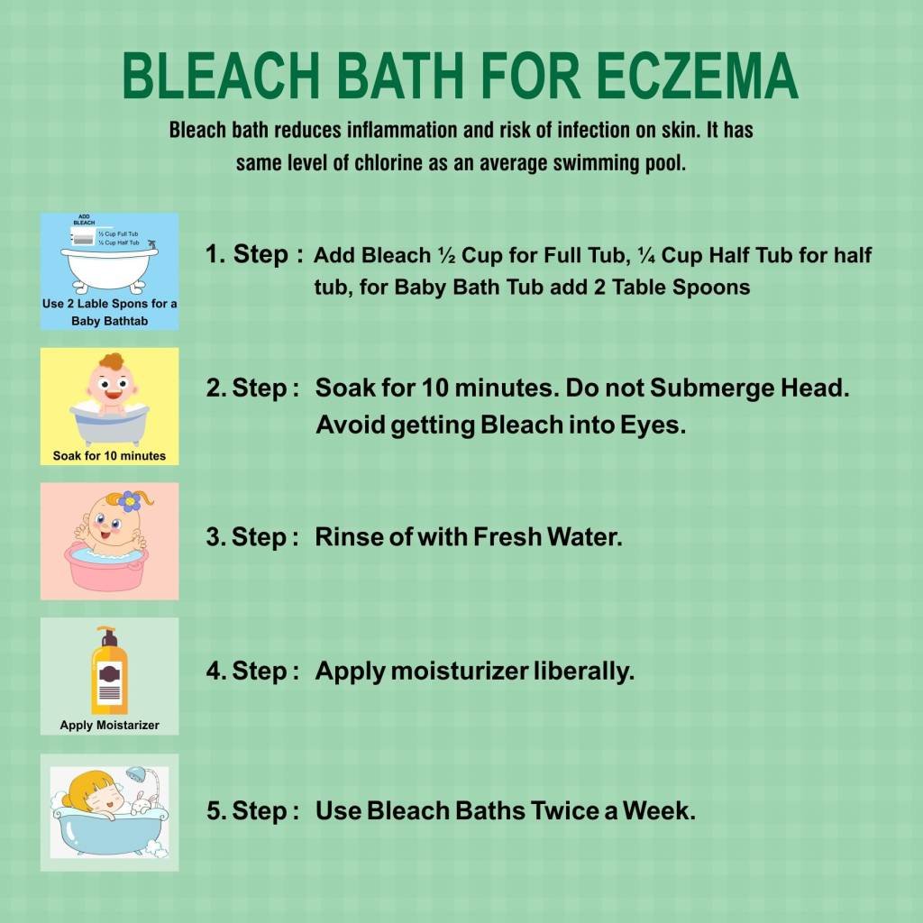Bleach Baths for children with Atopic dermatitis or eczema! – Dr. Ankit ...