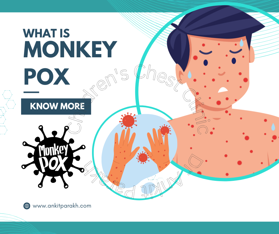 Current Status of Monkeypox in India: A 2024 Update - Dr. Ankit Parakh ...