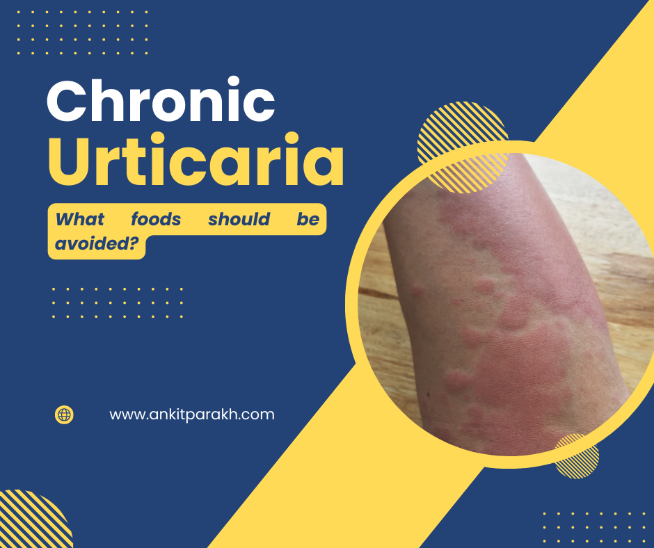 Food Allergy Urticaria Hives But No Urticaria what Could It Be Food Allergy Urticaria Hives But No Urticaria what Could It Be